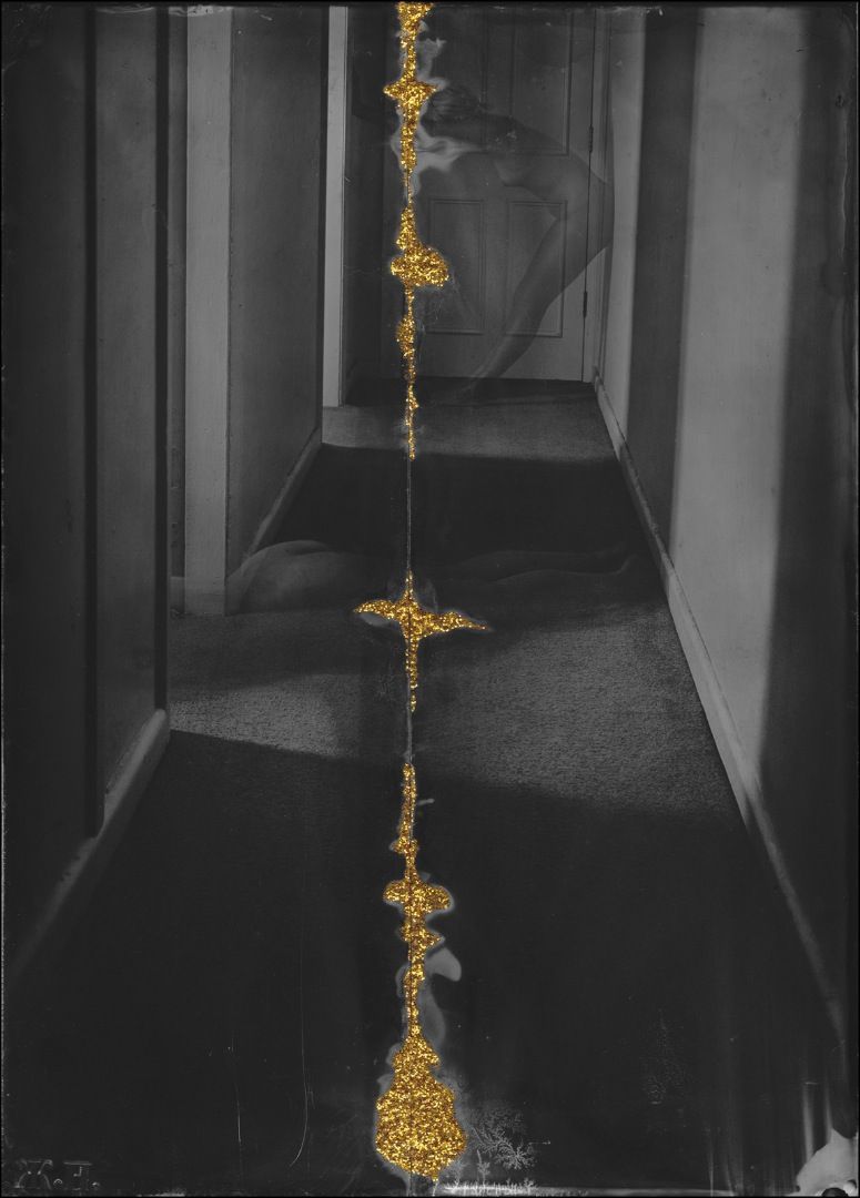 Golden Scars - Photographs and text by Zelko Nedic | LensCulture